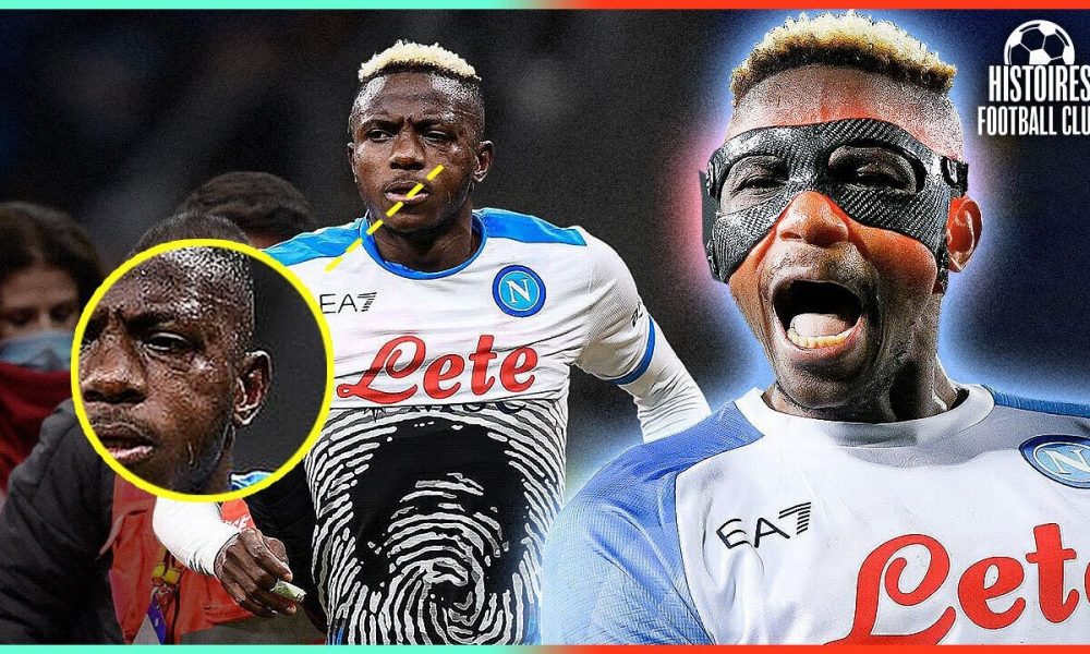La raison pour laquelle Victor Osimhen porte un masque sur le terrain ... La raison pour laquelle Victor Osimhen porte un masque sur le terrain ...